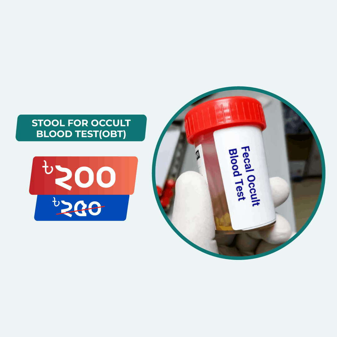 Stool For Occult Blood Test(Obt) - Arogga Online Lab