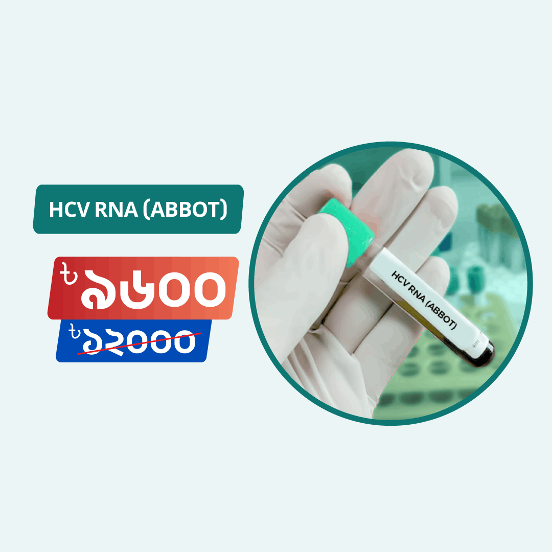 Hcv Rna (Abbot) - Arogga Online Lab