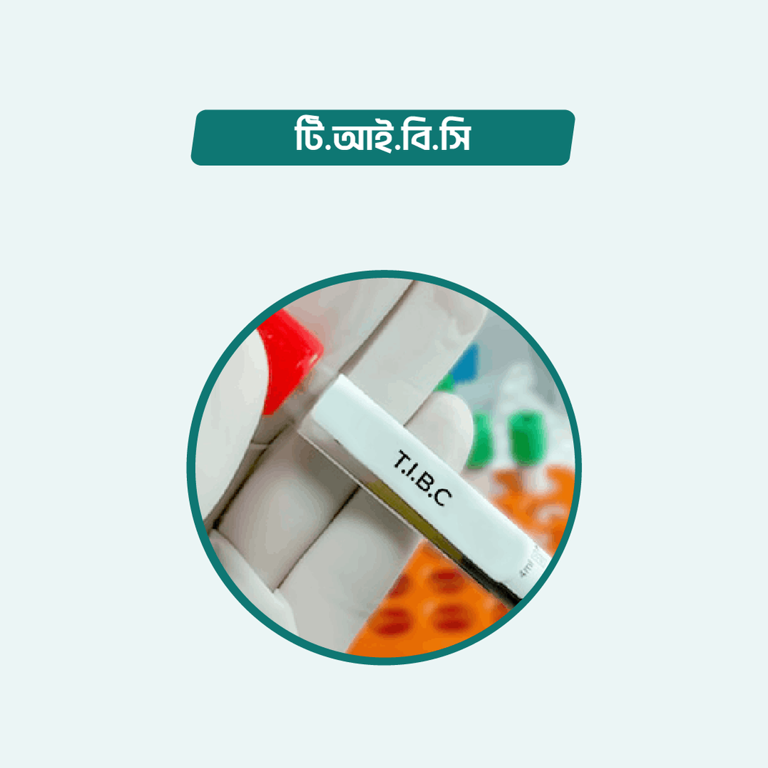 Book T. I. B. C. Lab test Online from Home - Arogga