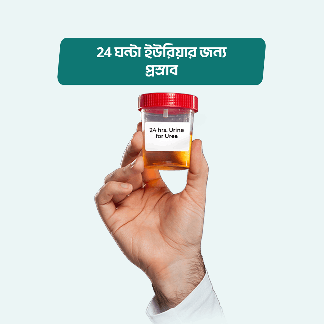 24 hrs. Urine for Urea - Arogga Online Lab