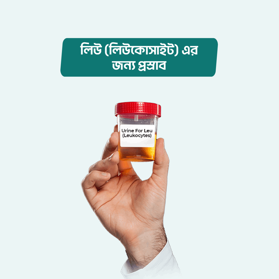 Urine For Leu (Leukocytes) - Arogga Online Lab