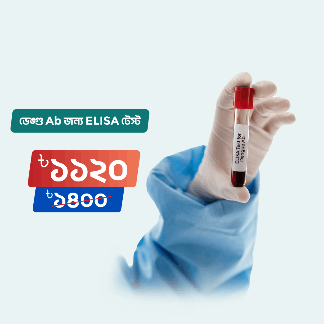 Elisa Test For Dengue Ab Arogga Online Lab