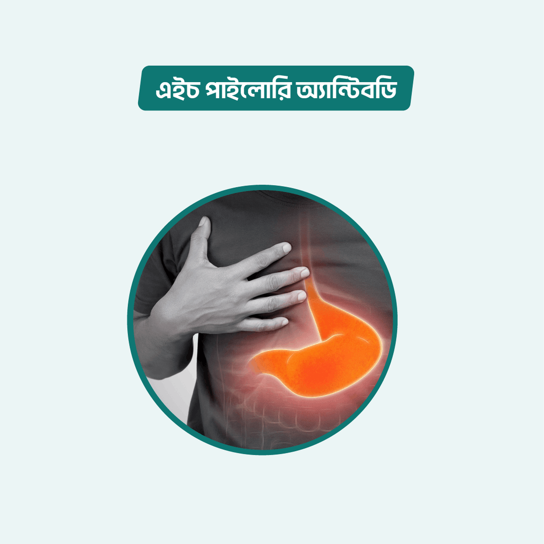 H. Pylori Antibody - Arogga Online Lab