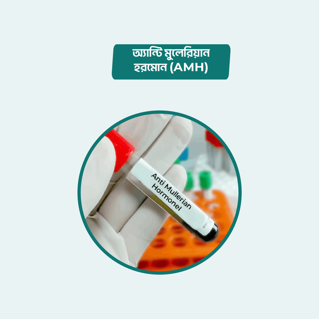 Anti-Mullerian Hormone (AMH) - Arogga Online Lab