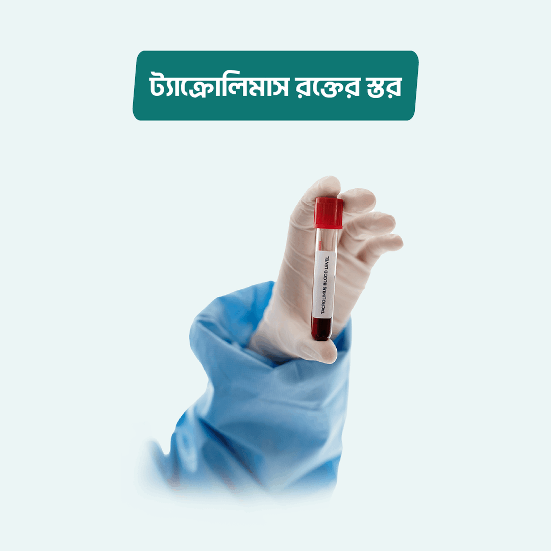 Book Tacrolimus Blood Level Lab test Online from Home - Arogga