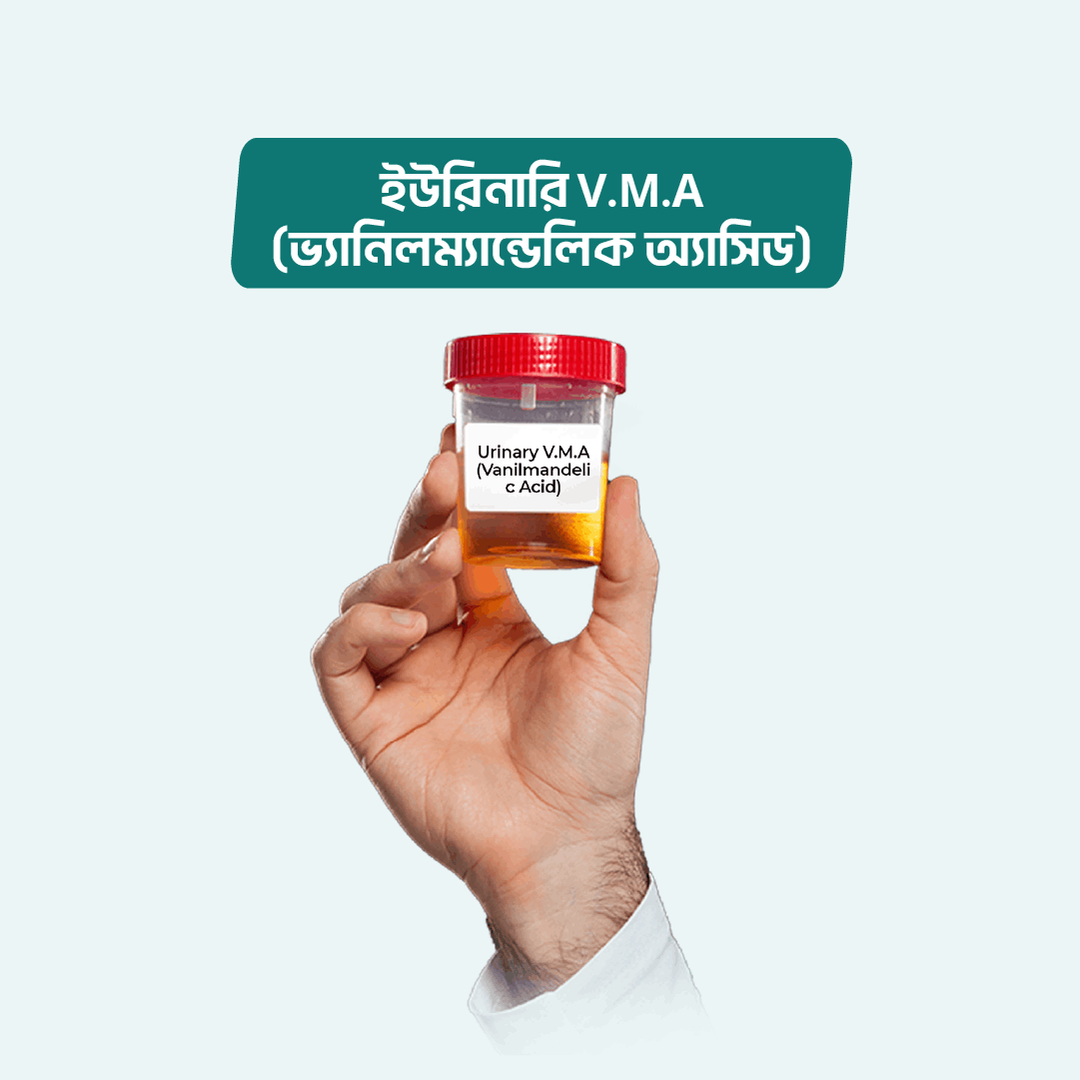 Book Urinary V.M.A (Vanilmandelic Acid) Lab test Online from Home - Arogga
