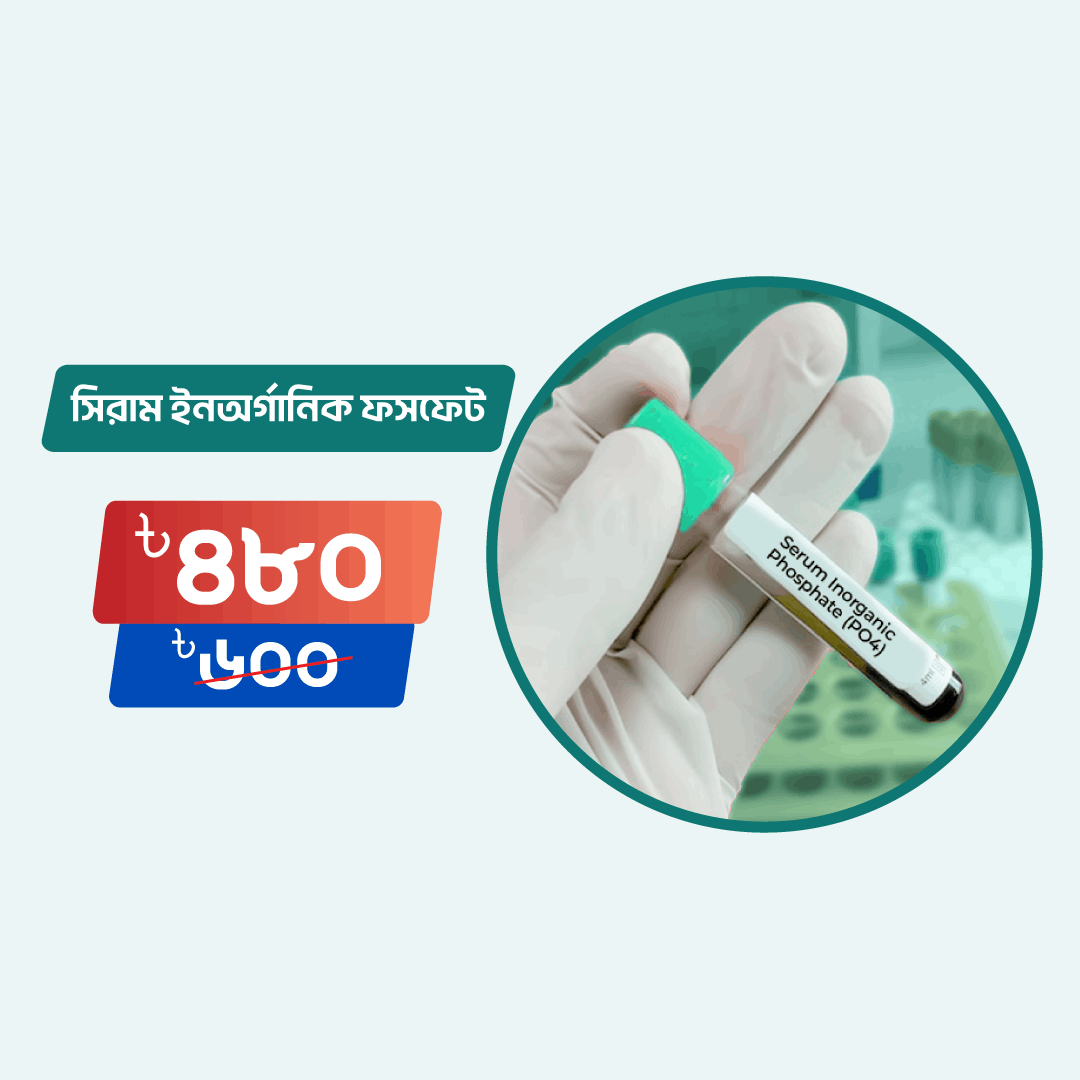 Serum Inorganic Phosphate (PO4) - Arogga Online Lab