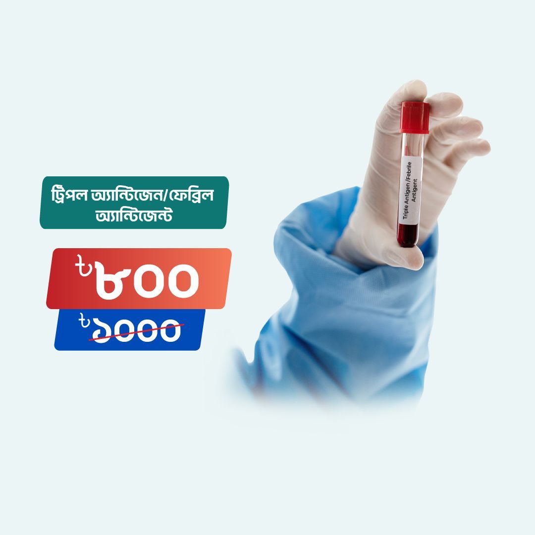 Triple Antigen /Febrile Antigent - Arogga Online Lab
