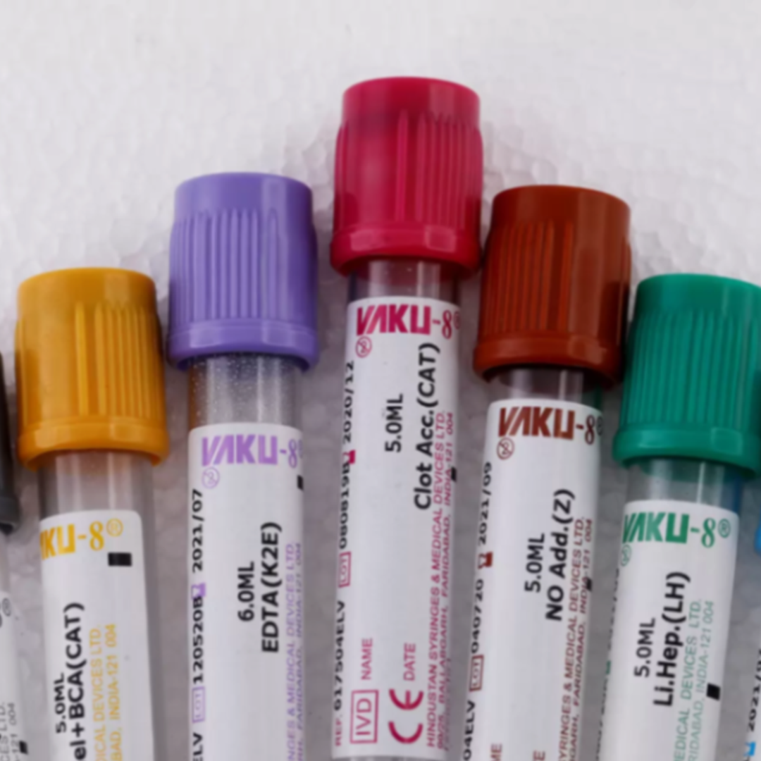 Book Bicarbonate Hco3 Lab Test Online From Home Arogga