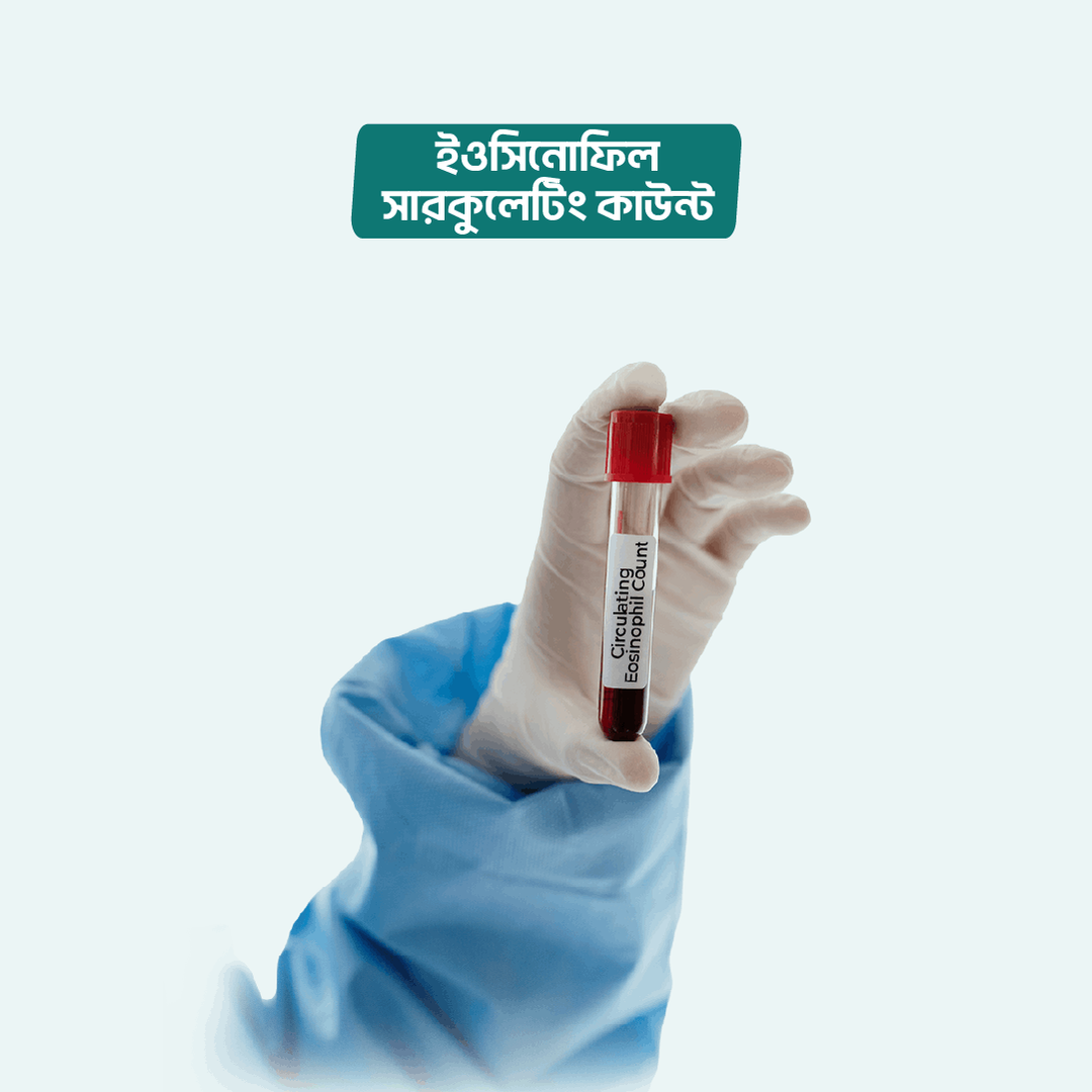 Circulating Eosinophil Count - Arogga Online Lab