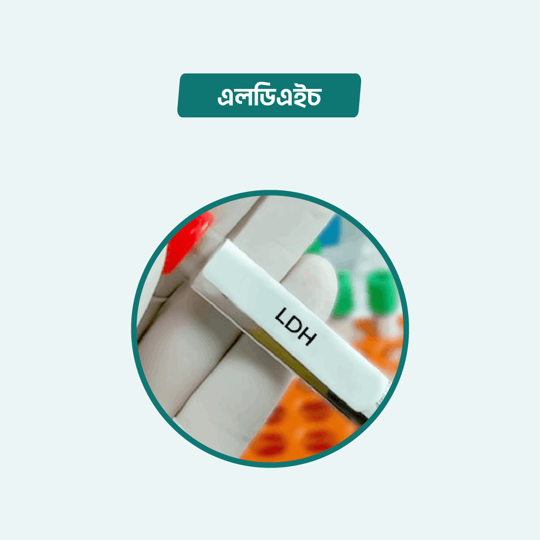 Book LDH Lab test Online from Home - Arogga