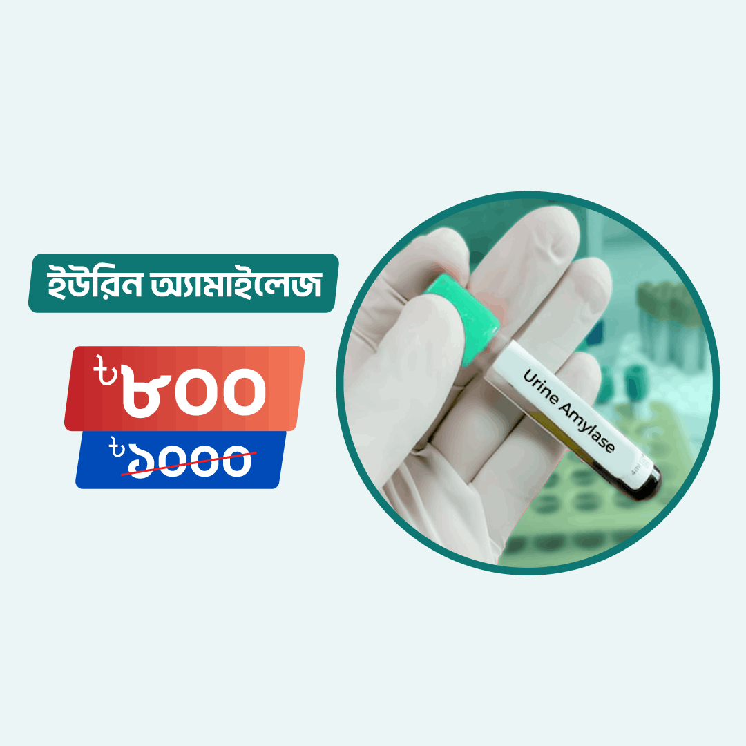 Urine Amylase - Arogga Online Lab