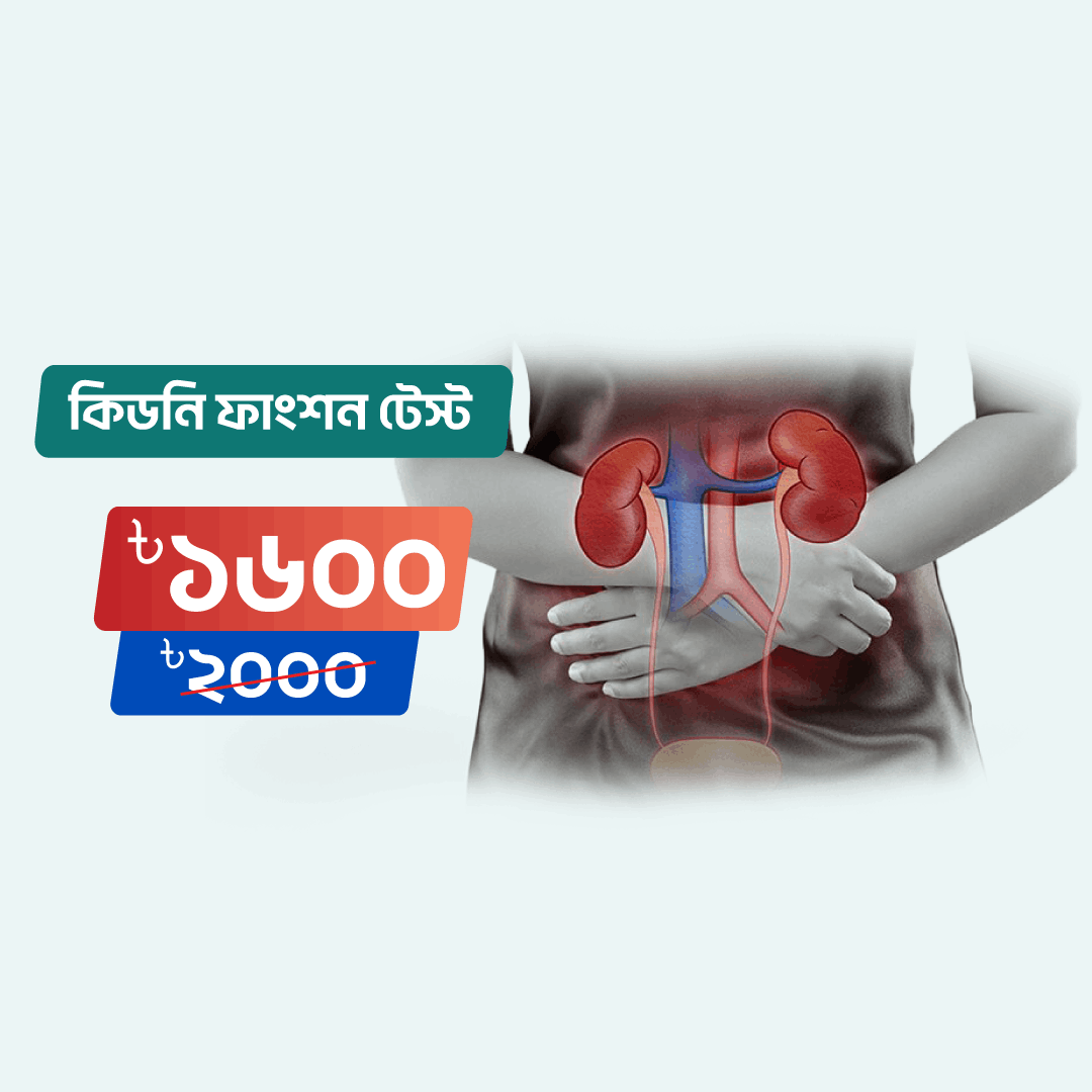 Kidney Function Test (KFT) - Arogga Online Lab