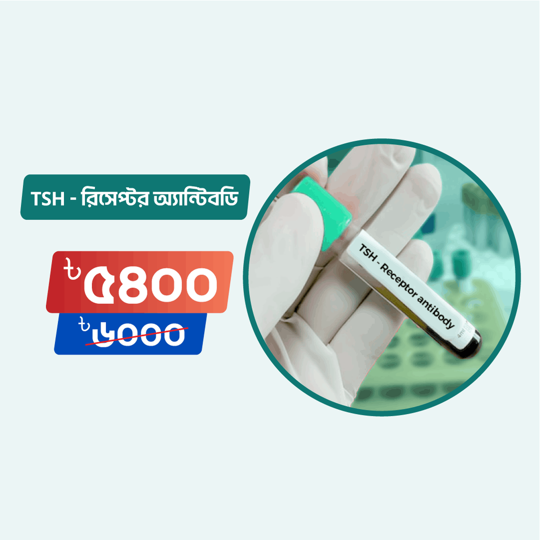 TSH - Receptor antibody - Arogga Online Lab