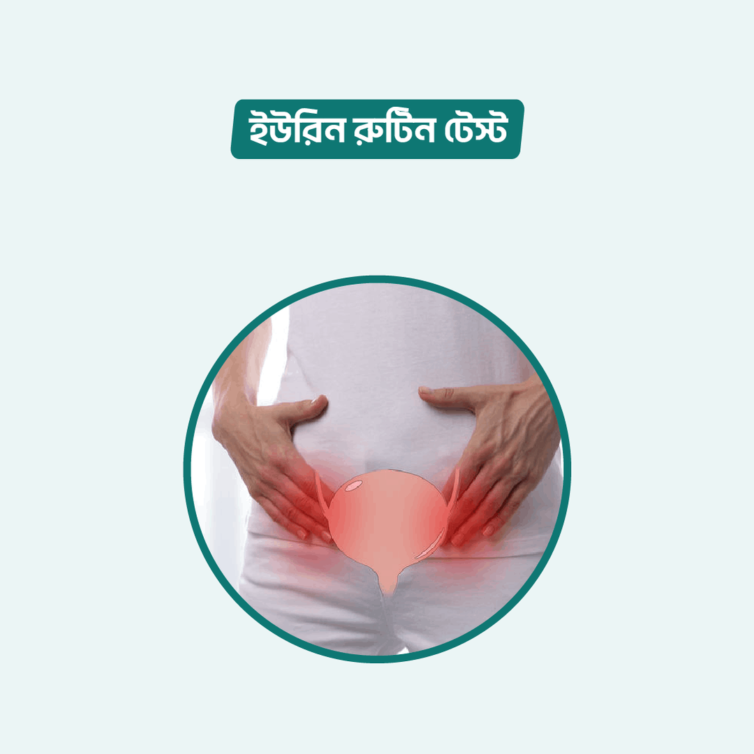 Urine Routine Examination (Urine R/E) - Arogga Online Lab