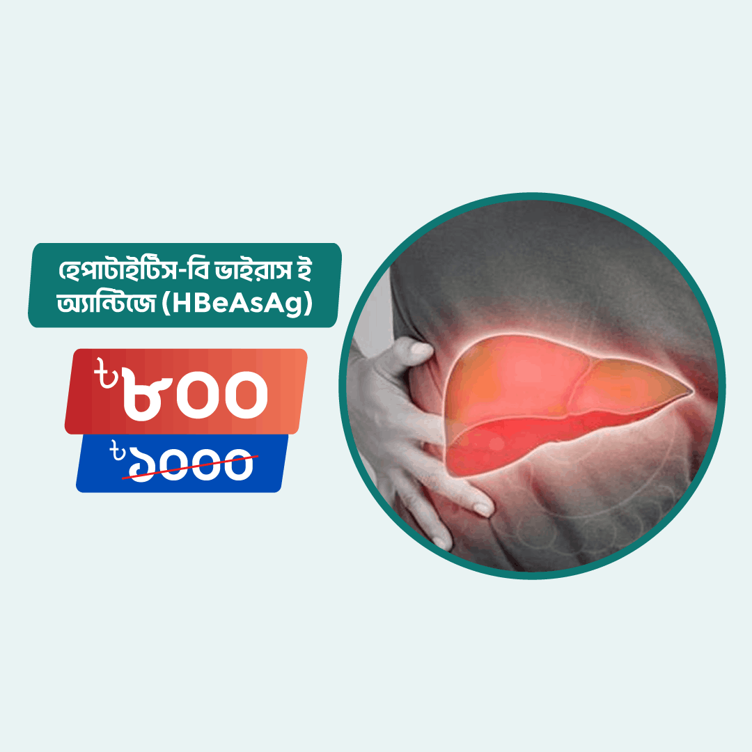 Hepatitis-B Virus E Antigen (HBeAg) - Arogga Online Lab