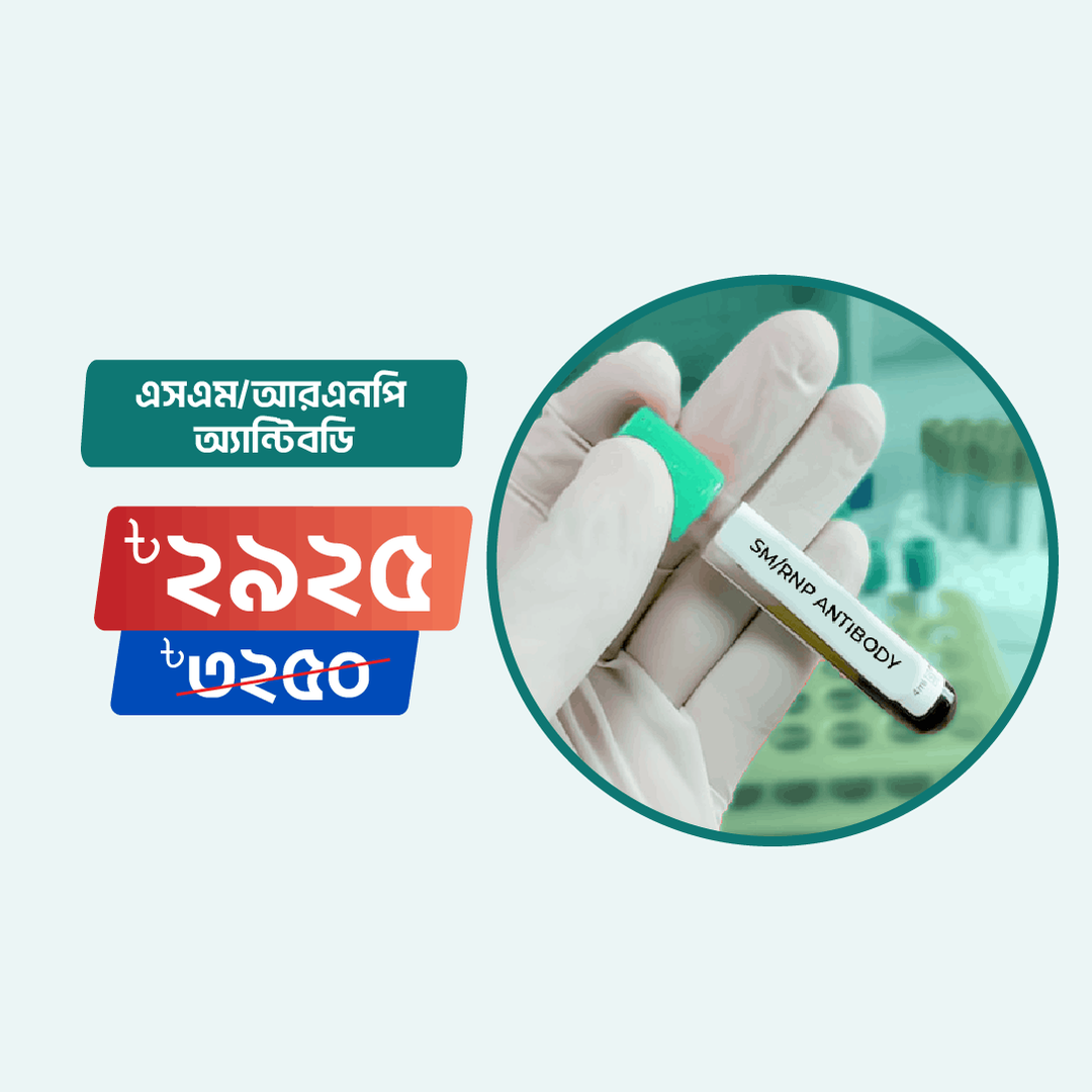 Sm/Rnp Antibody - Arogga Online Lab