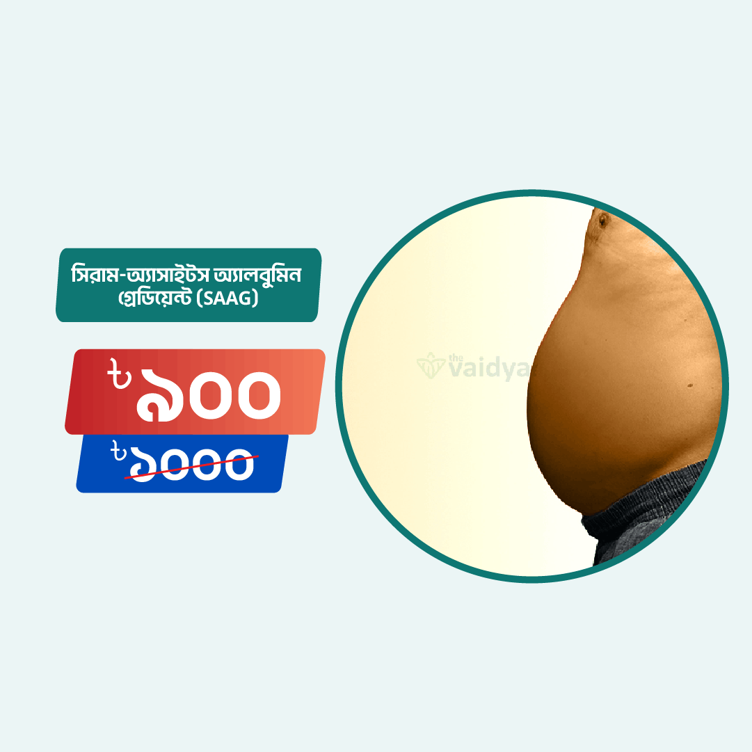 Serum-ascites albumin gradient(SAAG) - Arogga Online Lab