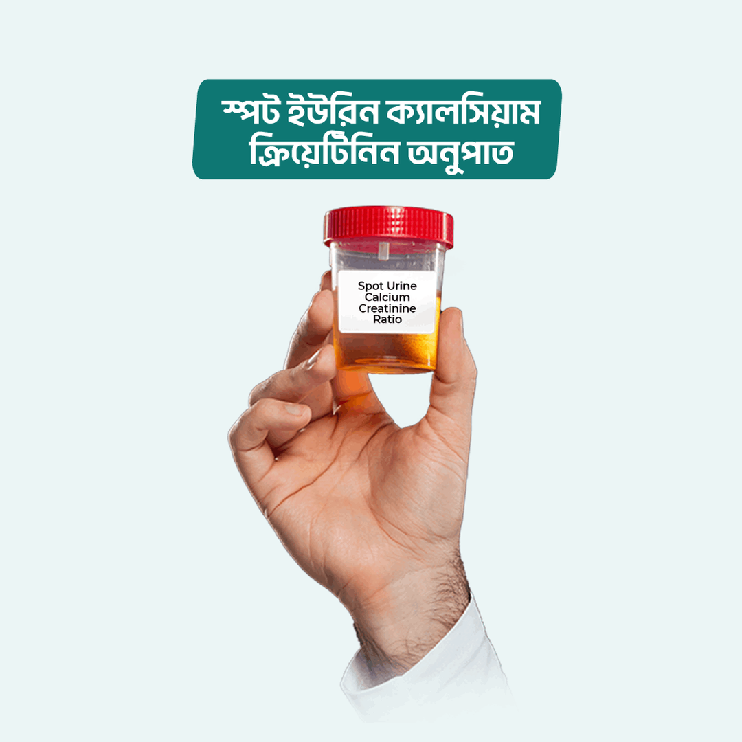 Spot Urine Calcium Creatinine Ratio - Arogga Online Lab