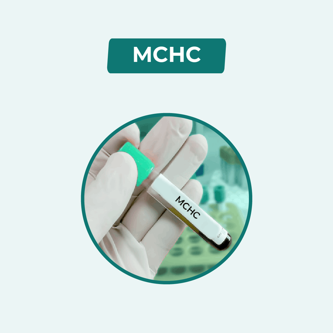 MCHC - Arogga Online Lab