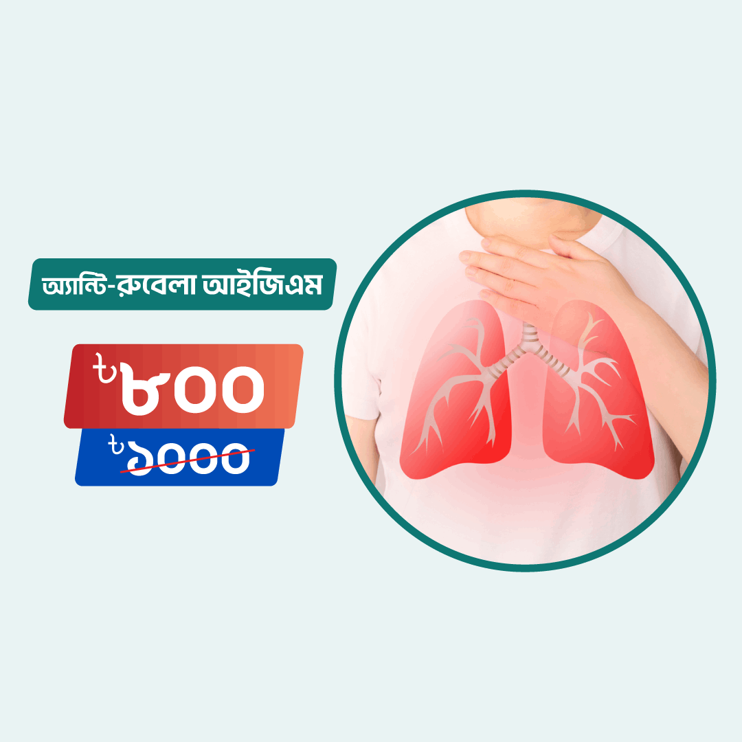 Anti-Rubella IgM - Arogga Online Lab