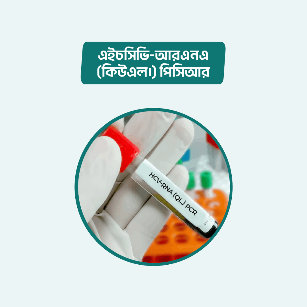 HCV-RNA (Ql.) PCR - Arogga Online Lab