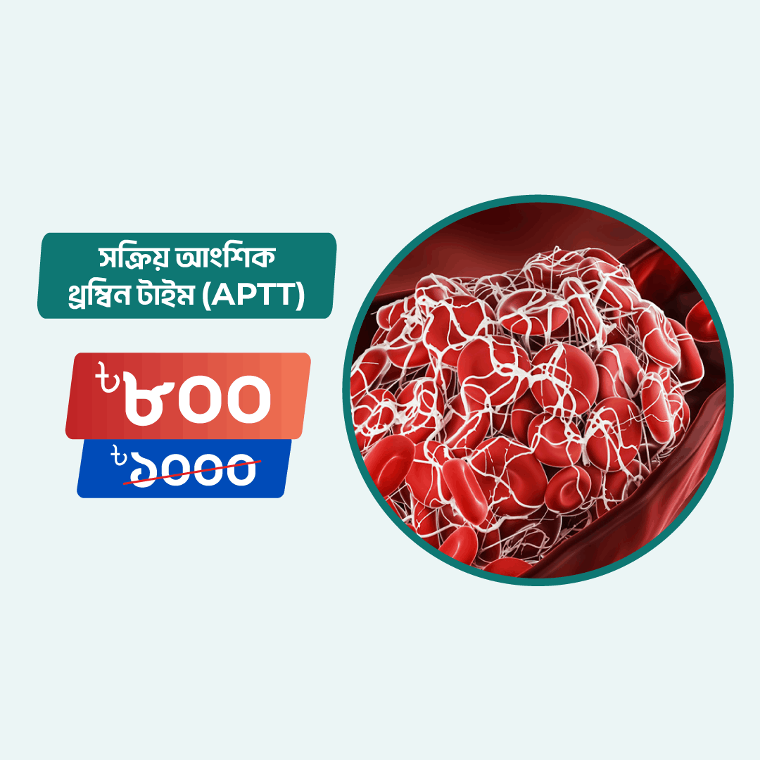 Activated Partial Thrombin Time (APTT) - Arogga Online Lab