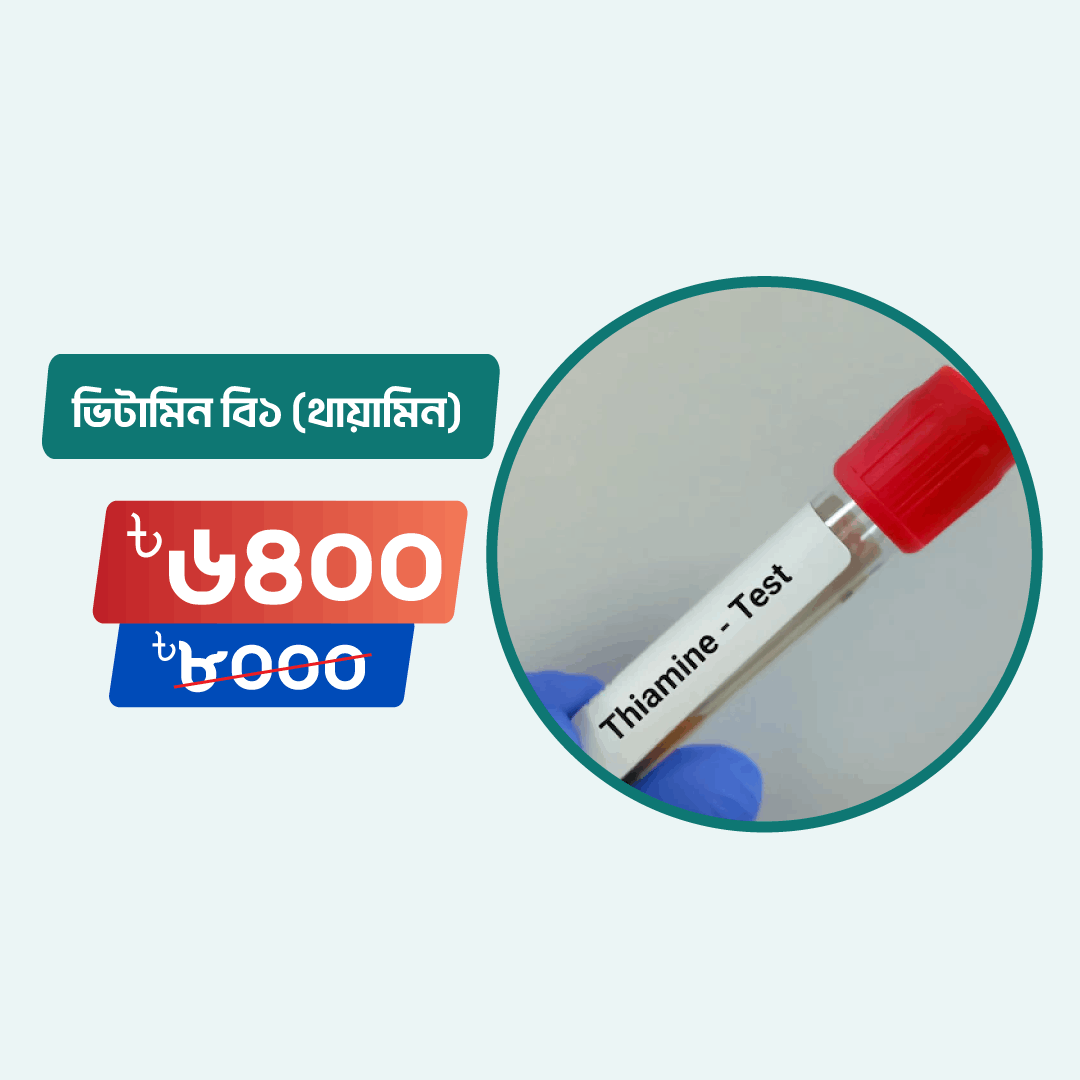 Vitamin B1(Thiamine) - Arogga Online Lab Vitamin B1(Thiamine) - Arogga Online Lab