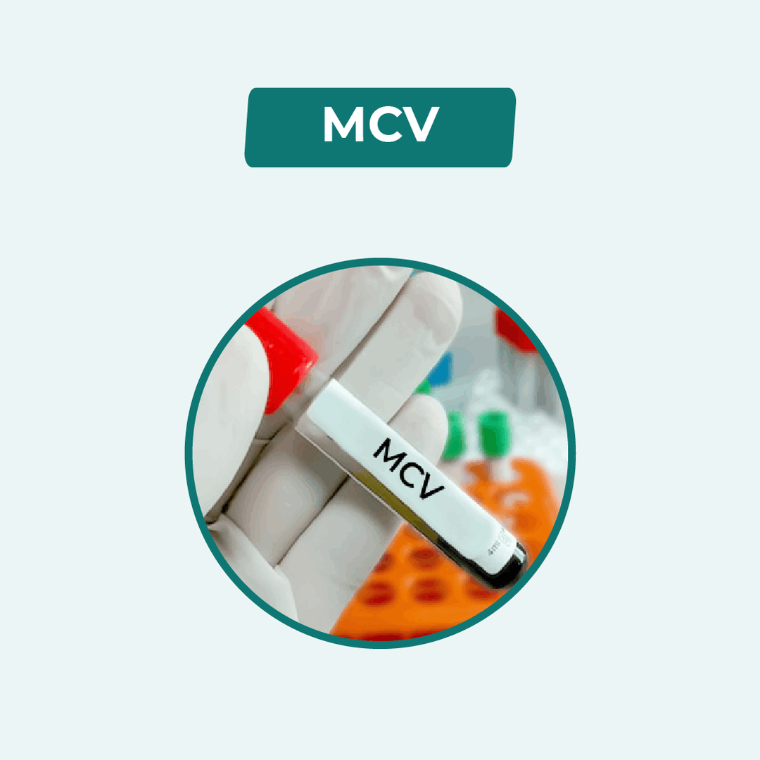 MCV - Arogga Online Lab