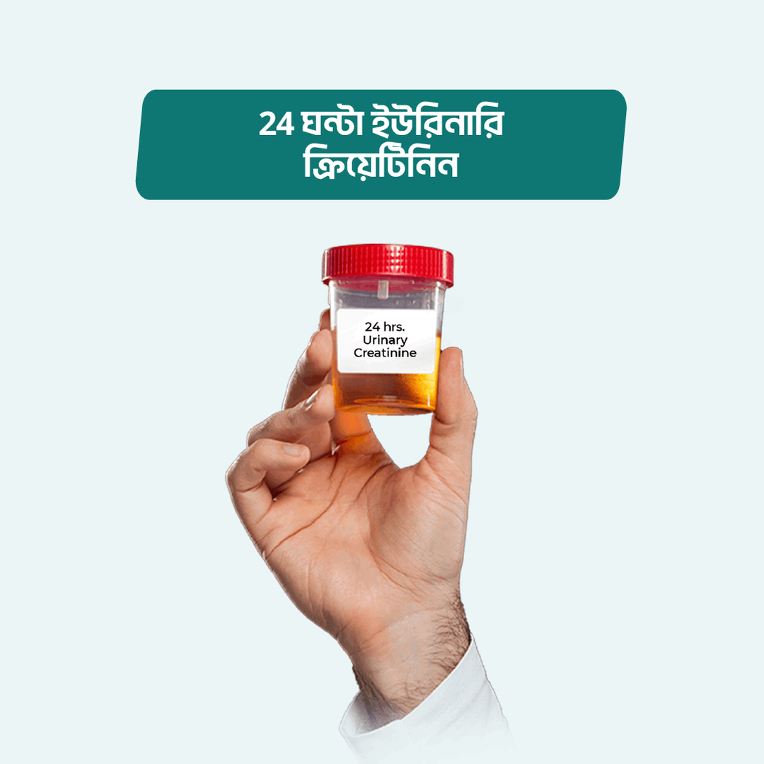 24 hrs. Urinary Creatinine - Arogga Online Lab