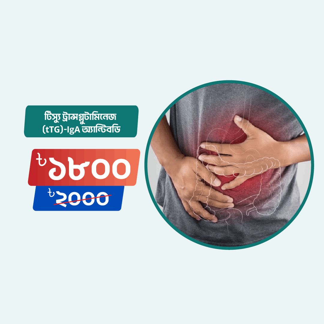 Book TISSUE TRANSGLUTAMINASE (tTG)-IgA ANTIBODIES Lab test Online from ...