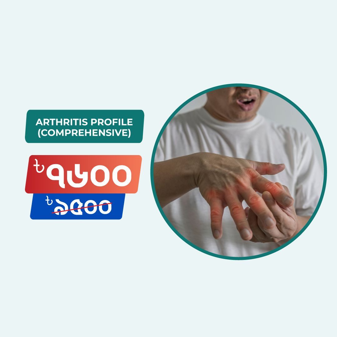 Arthritis Profile (COMPREHENSIVE) - Arogga Online Lab