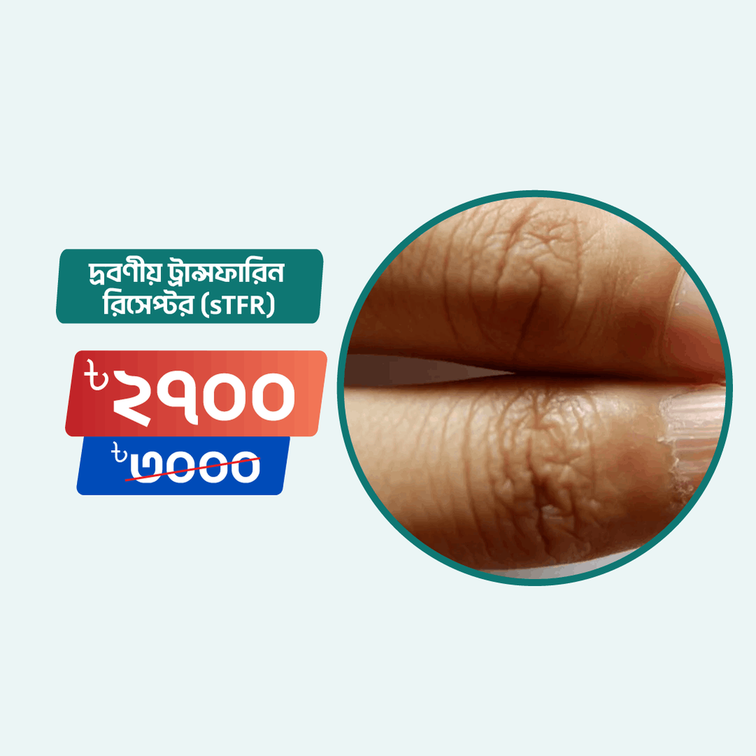 Soluble Transferrin Receptor (sTFR) - Arogga Online Lab