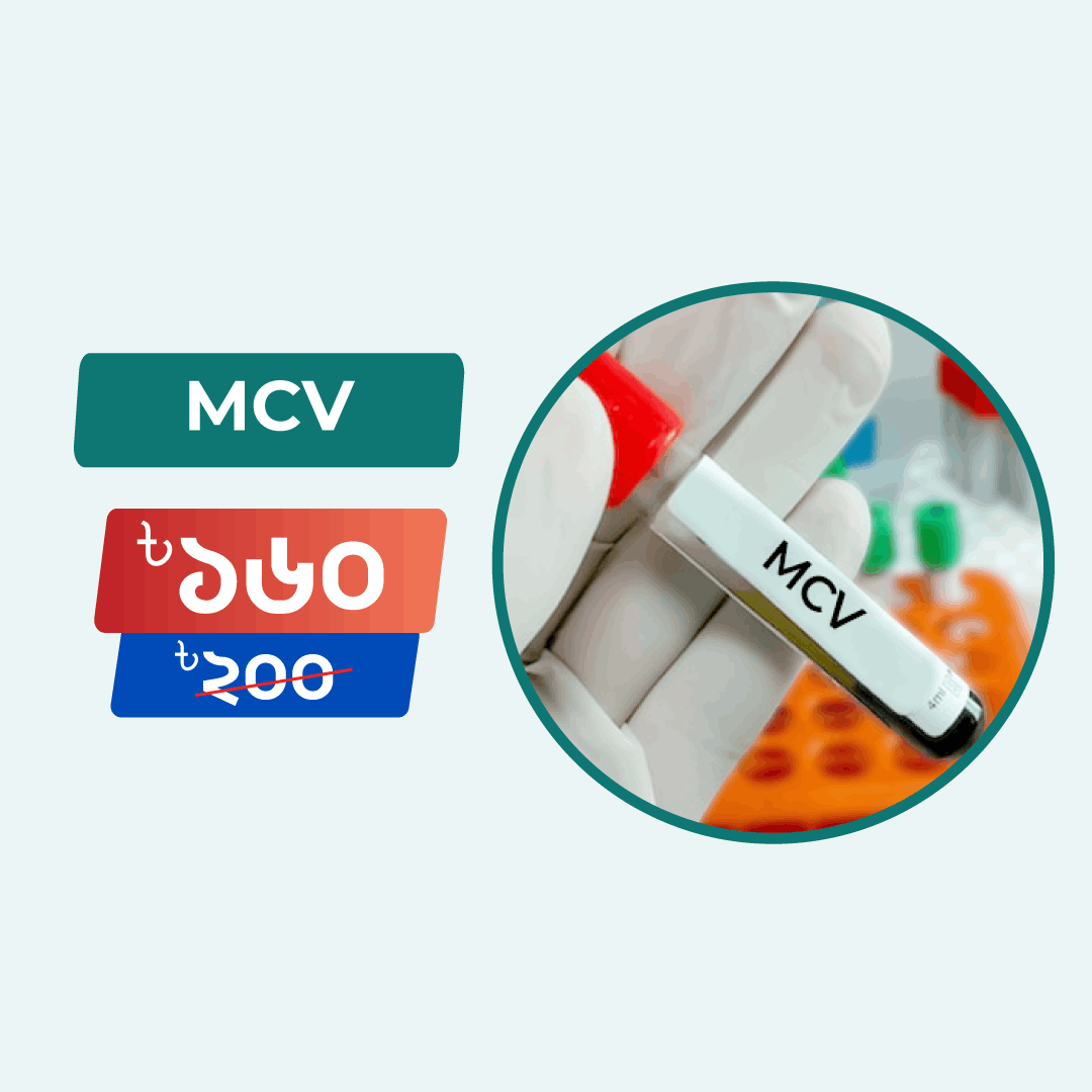 MCV - Arogga Online Lab