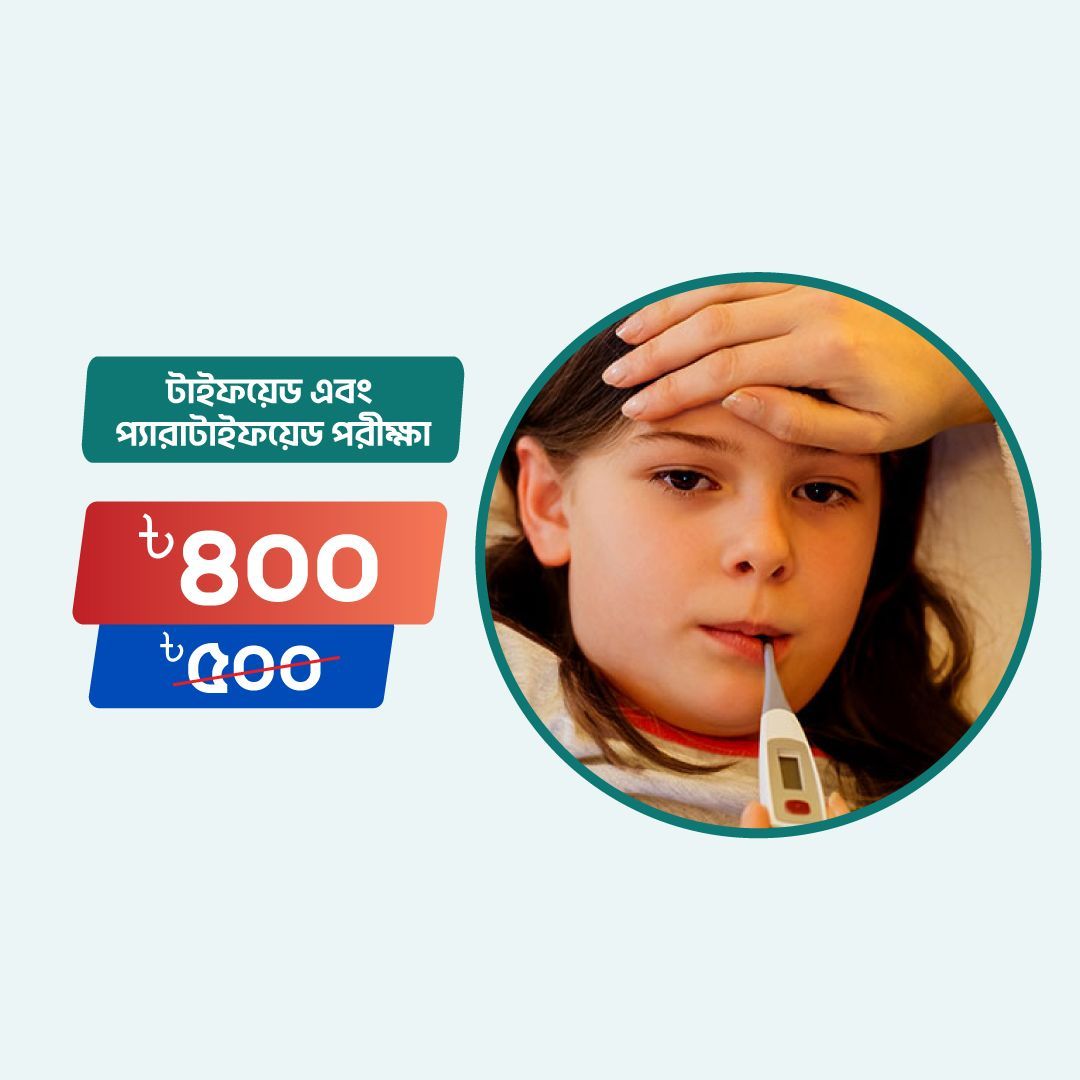 Typhoid and Paratyphoid Test - Arogga Online Lab