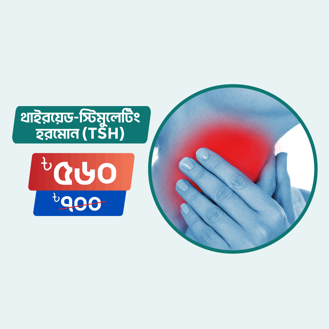 Thyroid-Stimulating Hormone (TSH) - Arogga Online Lab