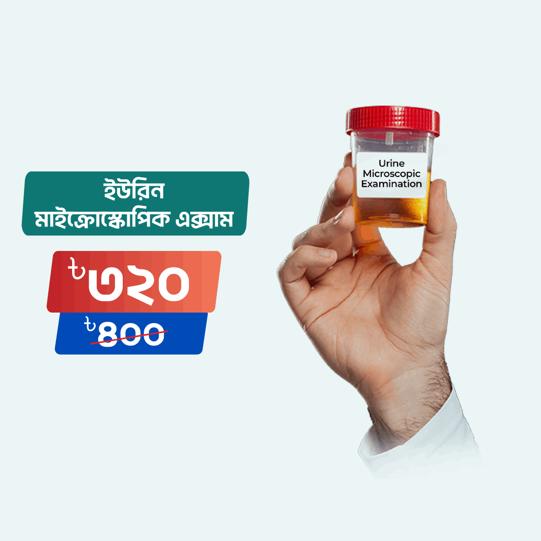 Urine Microscopic Examination - Arogga Online Lab