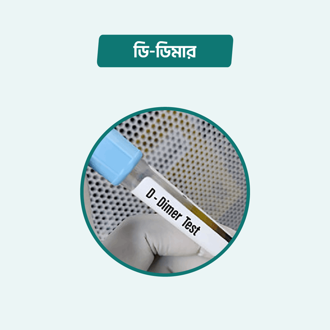 Book D - Dimer Lab test Online from Home - Arogga